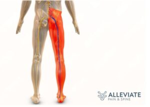 Understanding the MILD® Procedure: A Minimalist Approach to Lumbar ...
