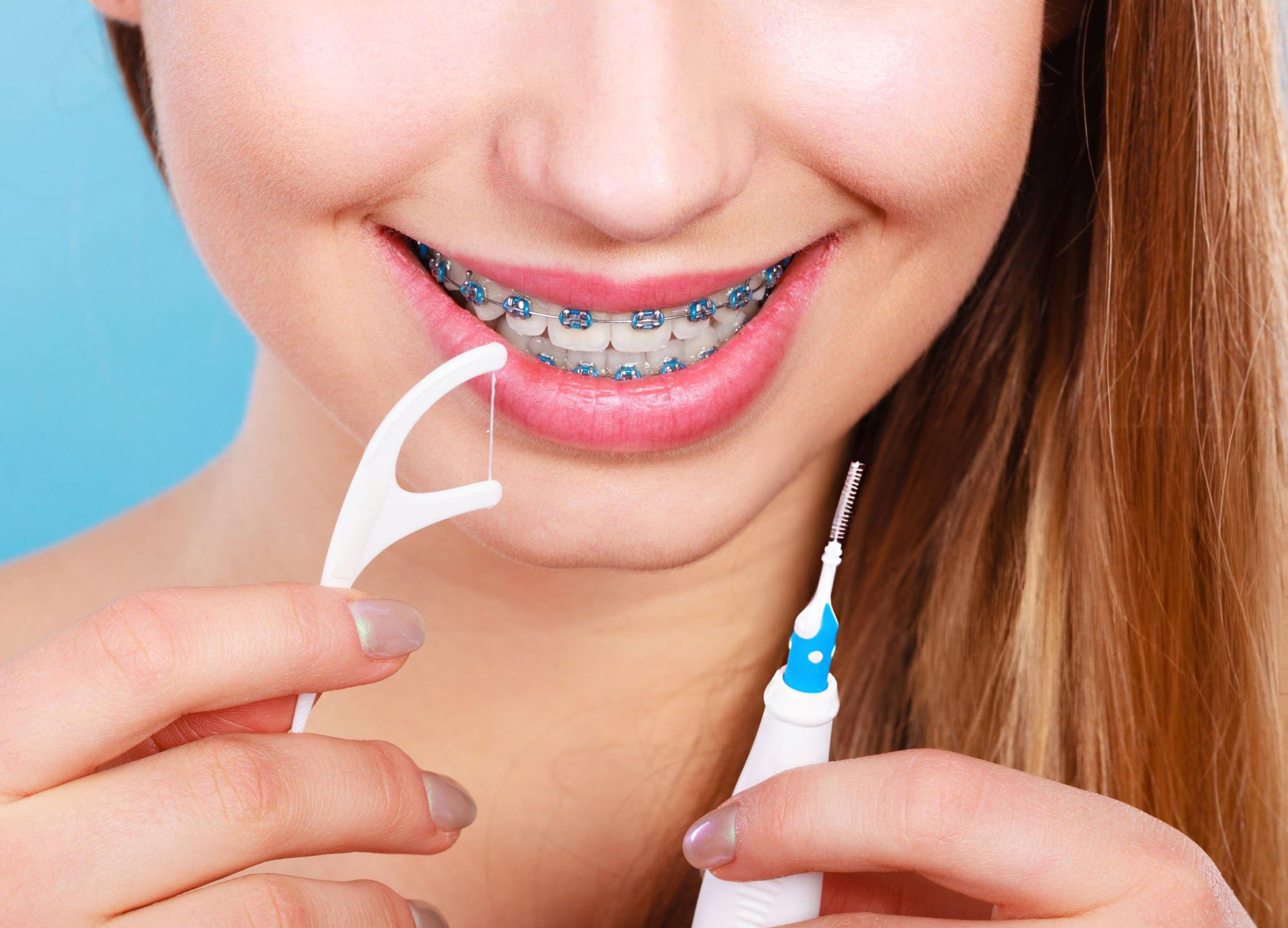 Orthodontic Spacers: Types, Uses, and Importance in Creating Space for ...