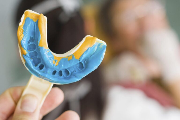 Teeth Prepped for Veneers: A Conservative Step-by-Step Process